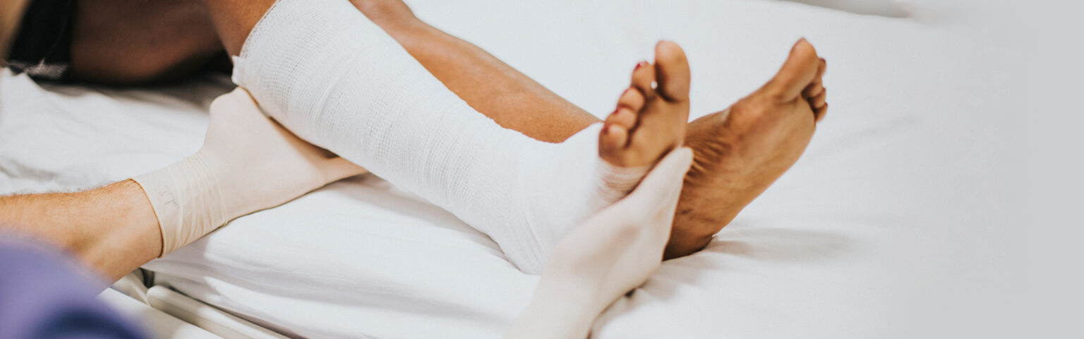 Cracked Shin Bone: Symptoms, Emergency Treatment and Recovery